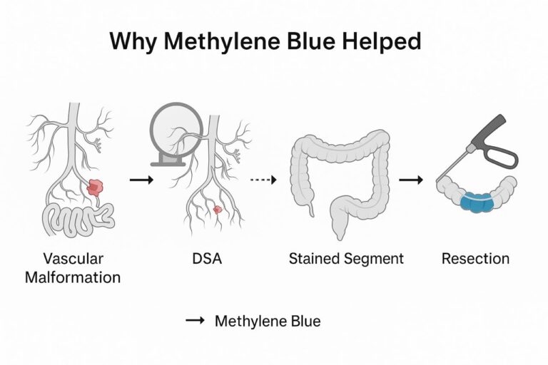 Methylene Blue Surgery: The Clever Trick Doctors Now Use to Find and ...